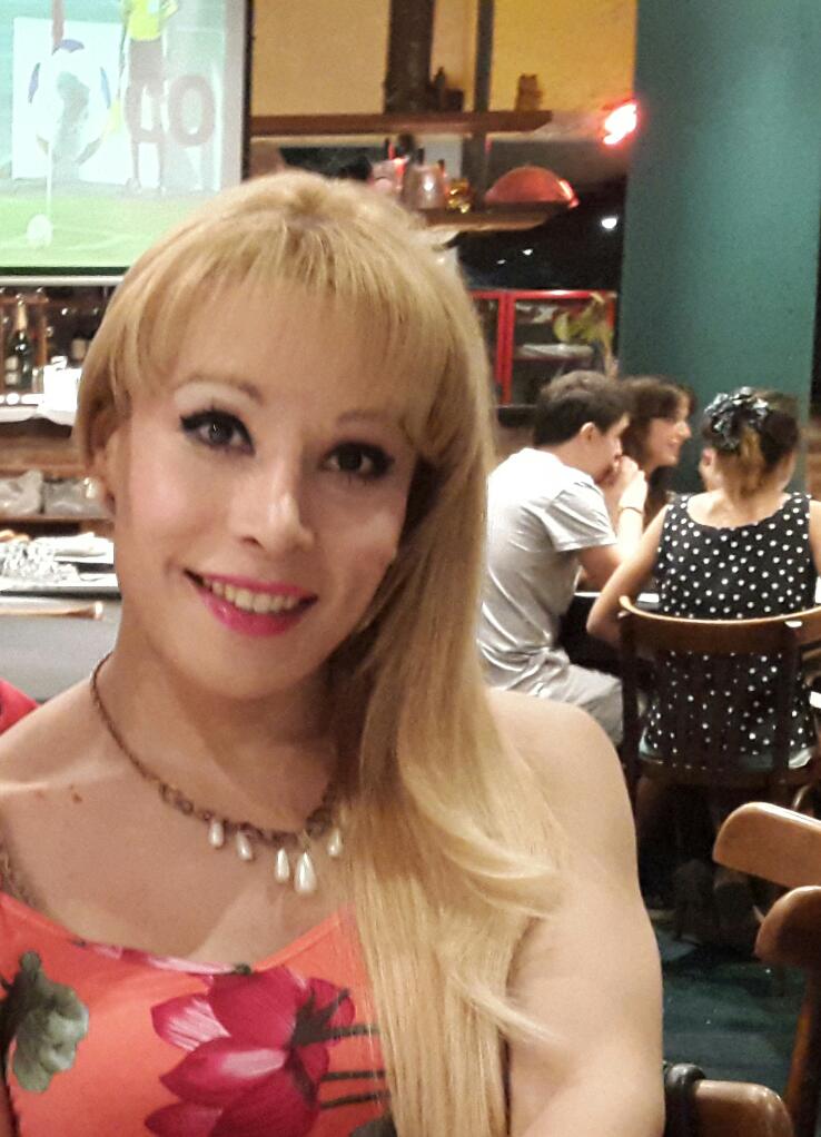 Facial Feminization Surgery Before And After Ffs Pictures